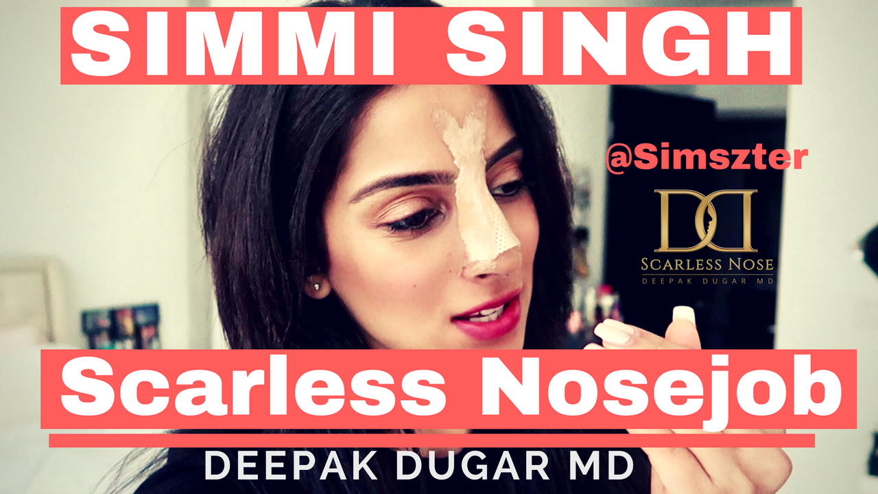 Simmi Singh's Rhinoplasty Journey with Dr. Deepak Dugar MD - Dr. Deepak ...