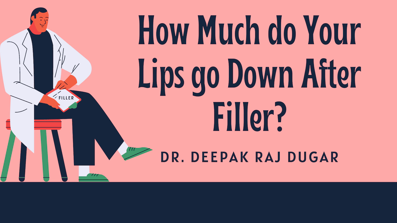 How Much do Your Lips go Down After Filler?