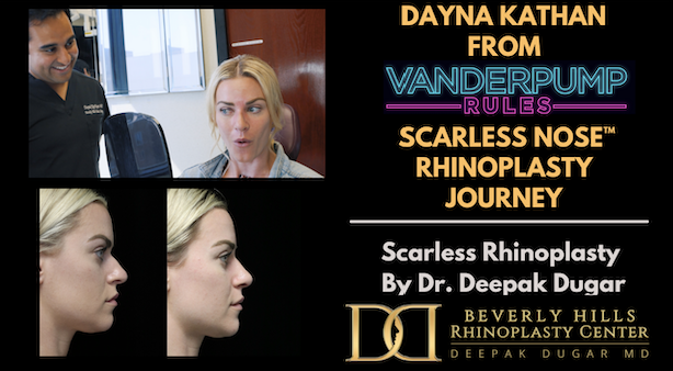 Vanderpump Rules star, Dayna Kathan's Journey to a Scarless Nose ...