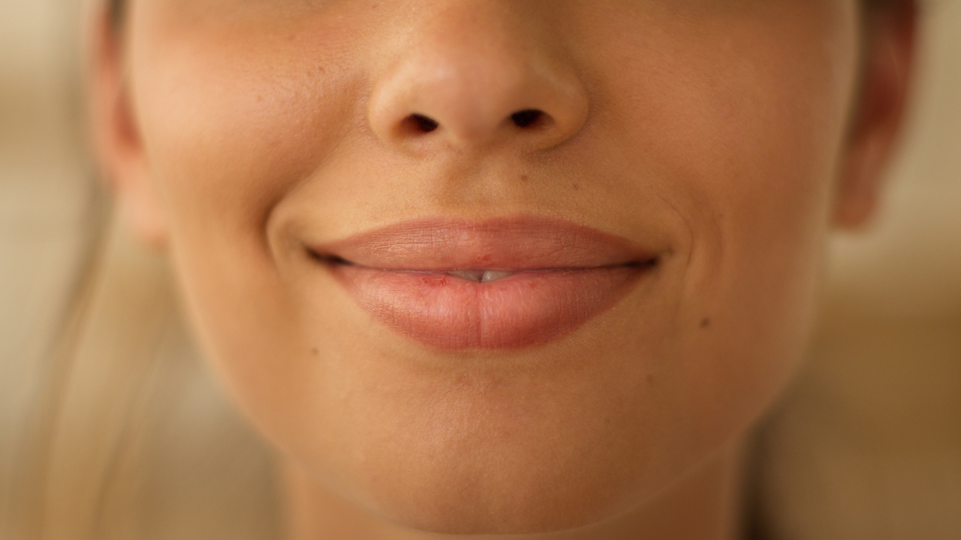 Do Lip Fillers Permanently Stretch out Your Lips? - Dr. Deepak Dugar M.D.