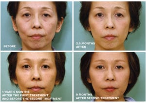 Growth Factors: The All-Natural Fix for a Younger Looking Face | Blog ...