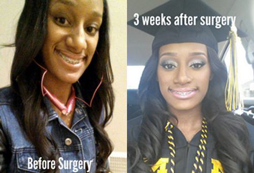 Plastic Surgery Michigan - Ann Arbor Plastic Surgery