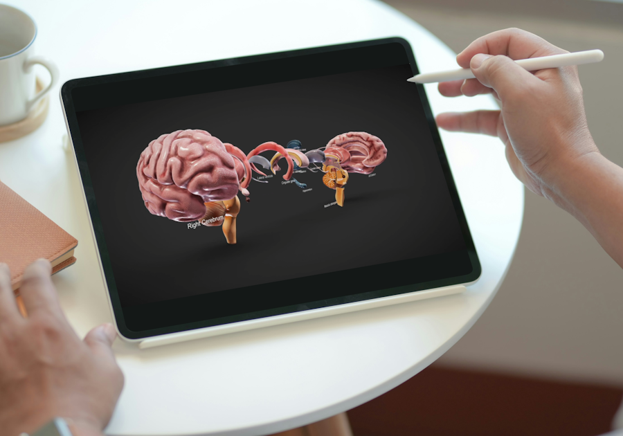 3D Interactive Medical Solutions | BluemotionMedical