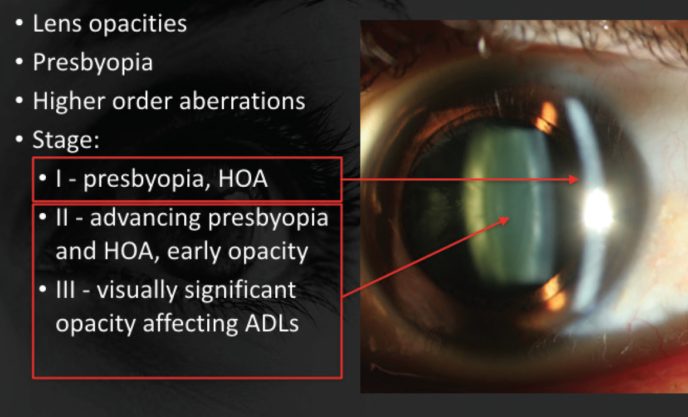 How to Present RLE to Patients in Three Simple Steps | Blog & News ...