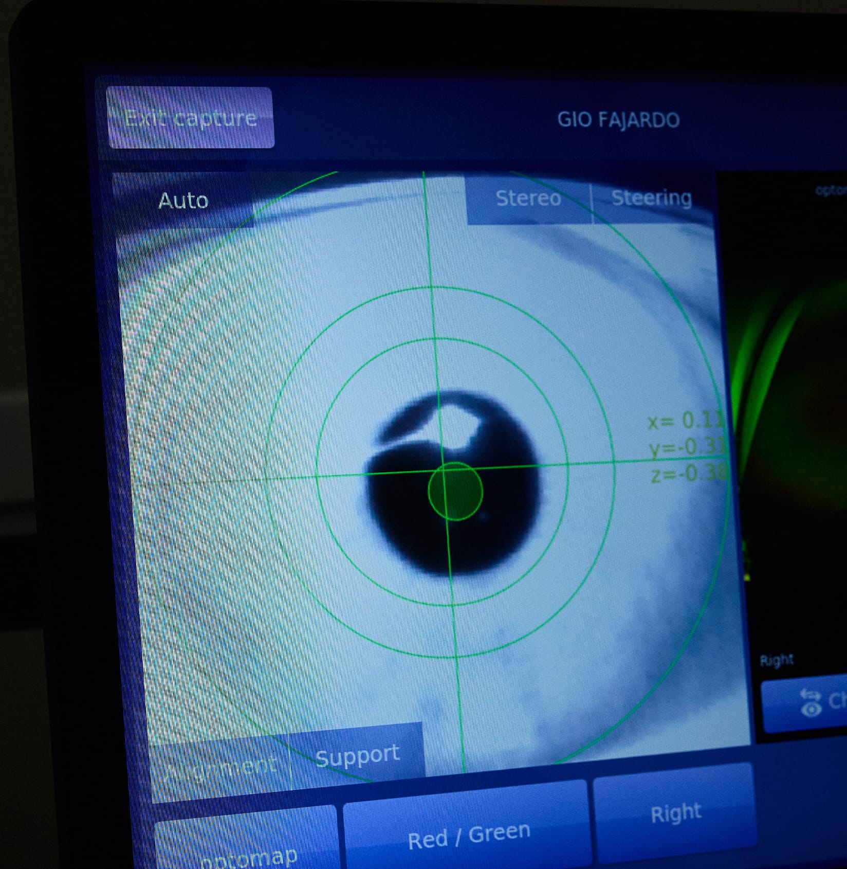 Clear Lens Exchange in Raleigh & Oxford, NC | New Century Ophthalmology