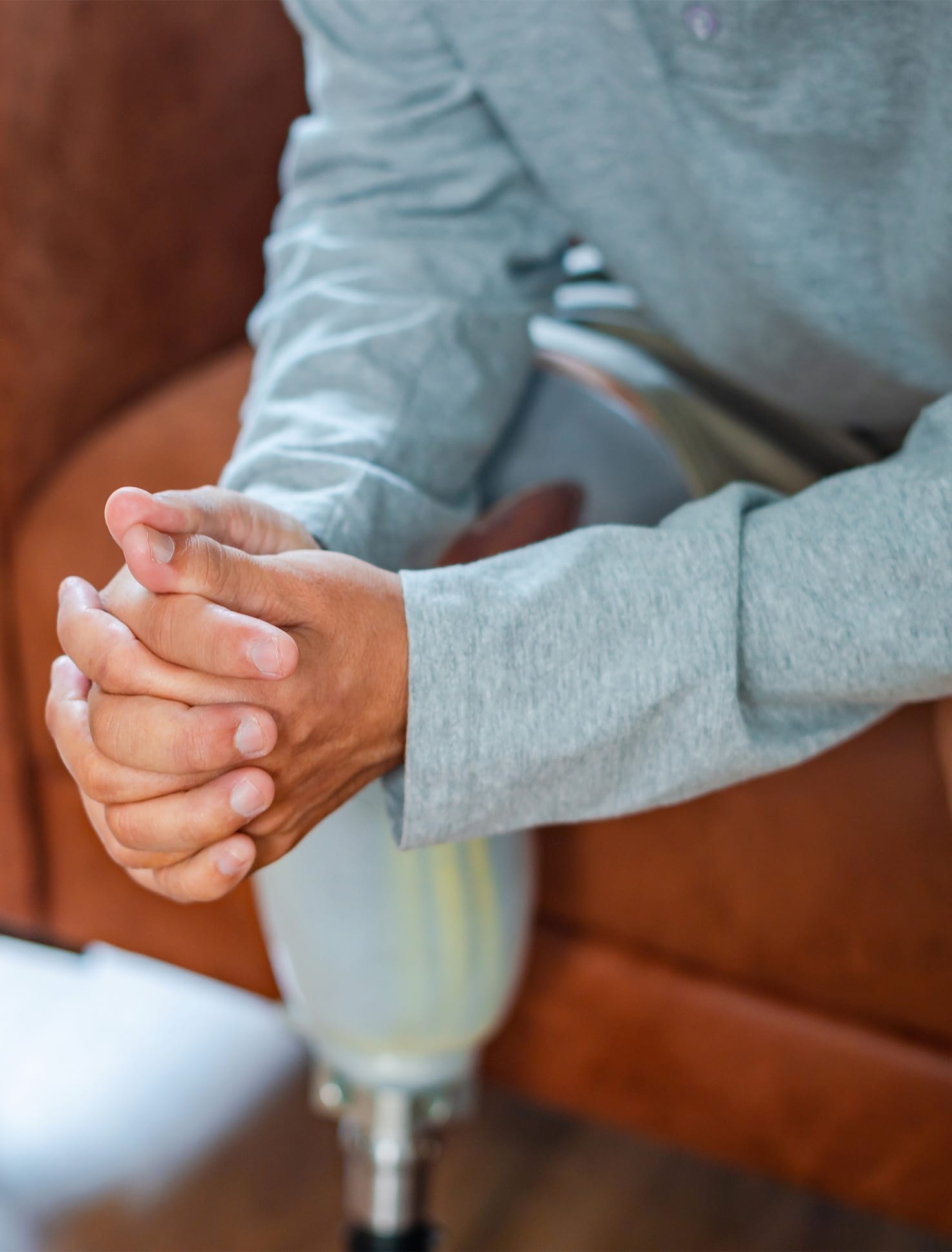 Amputation Attorney Palm Springs | Christopher C. Vader P.C.