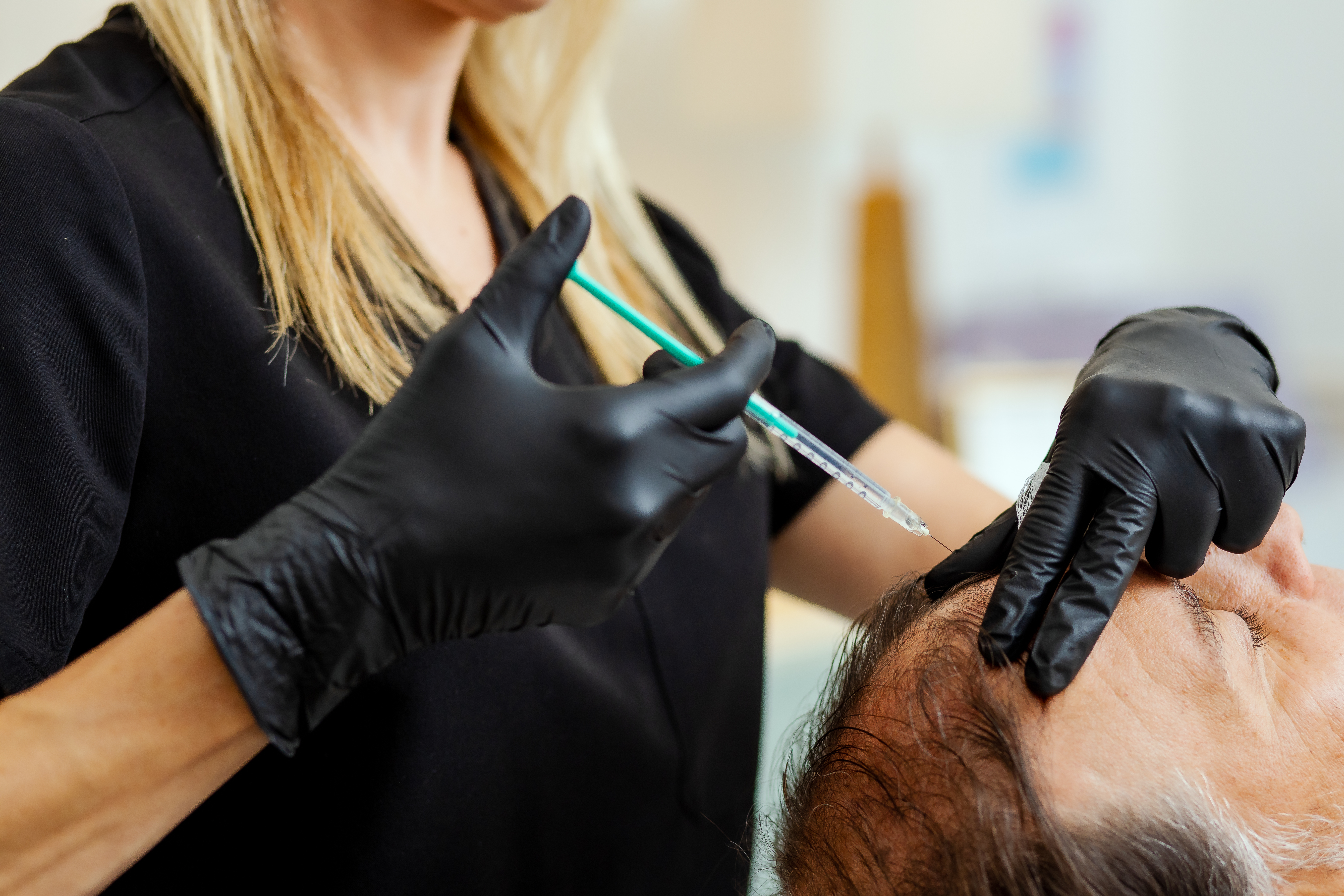 Exosome Therapy for Men’s Hair Loss: A Cutting-Edge Solution for ...