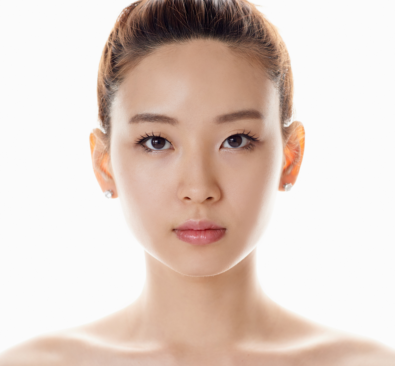 Lower Eyelid Surgery Portland | Portland Face Doctor
