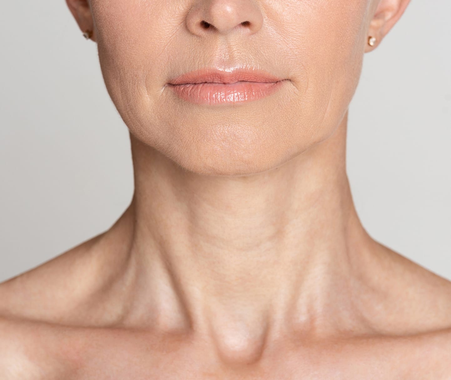 Neck & Décolleté Treatments in Annapolis, MD | Adoro Medical Spa