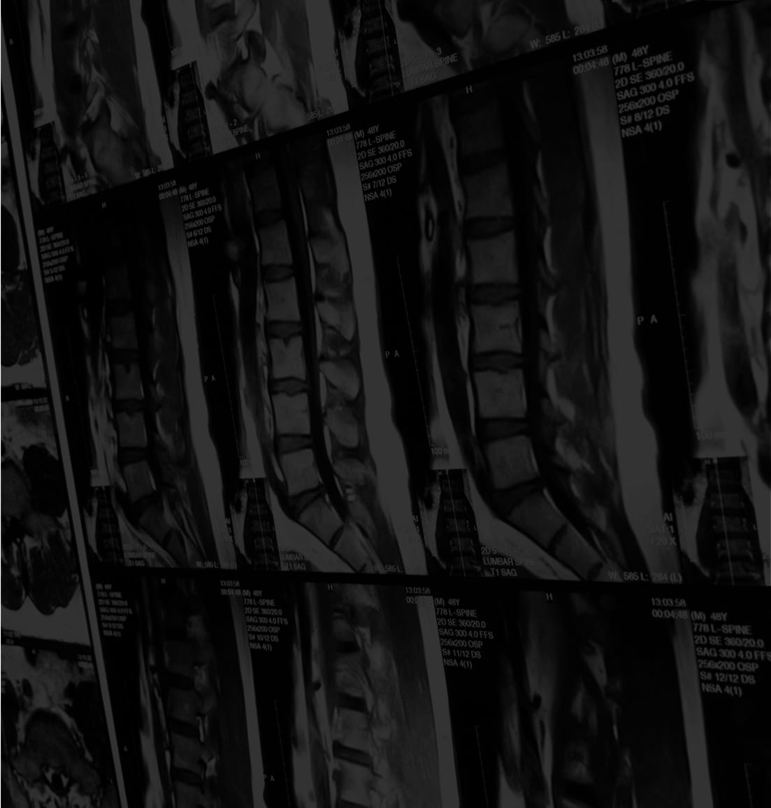 Orthopedic Spinal Surgeon NYC | Spine Doctor in New York City | Gerling ...