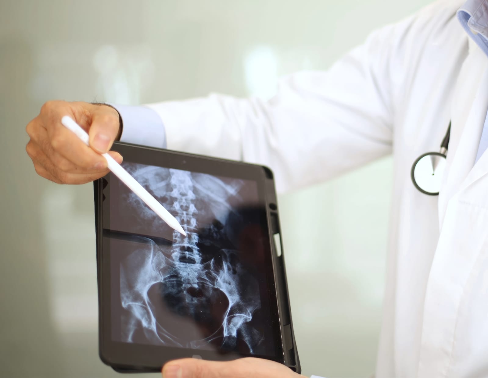 Medial Branch Block Injections in New Jersey | Gerling Spine Care and ...