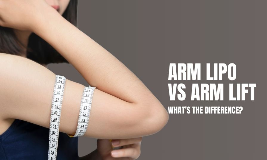 Arm Lipo vs Arm Lift: What's the Difference? | Dr. Galanis