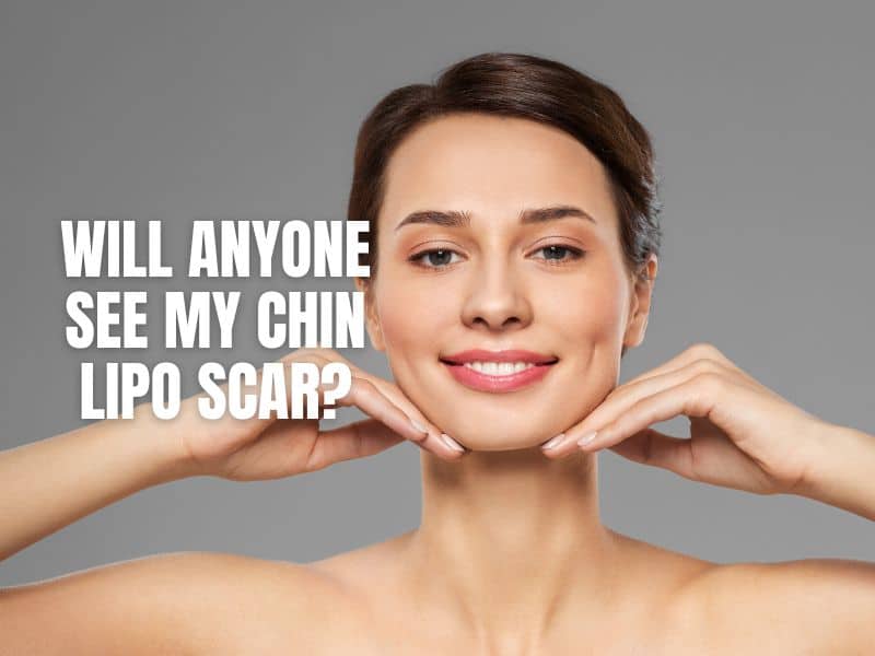 Will Anyone See My Chin Lipo Scar? | Galanis Plastic Surgery