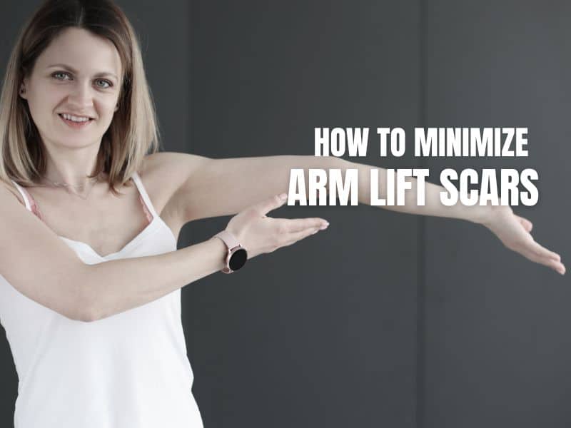 How to Minimize Arm Lift Scars | Galanis Plastic Surgery