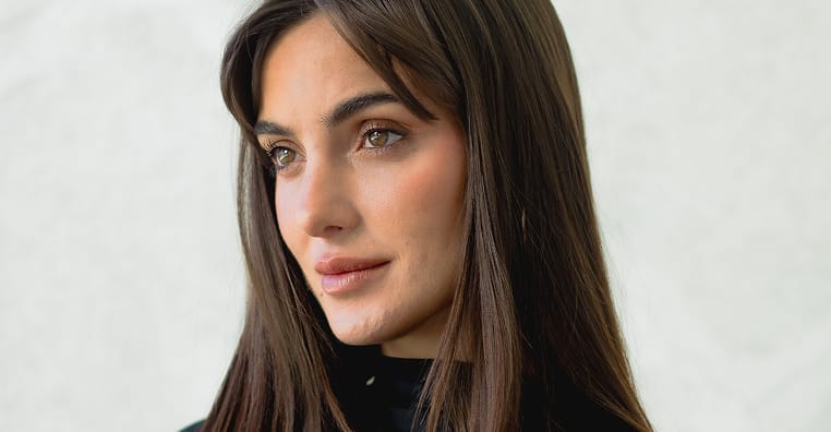 Lower Blepharoplasty Before & After Photos | Page 2 | Vegas Facial Plastics