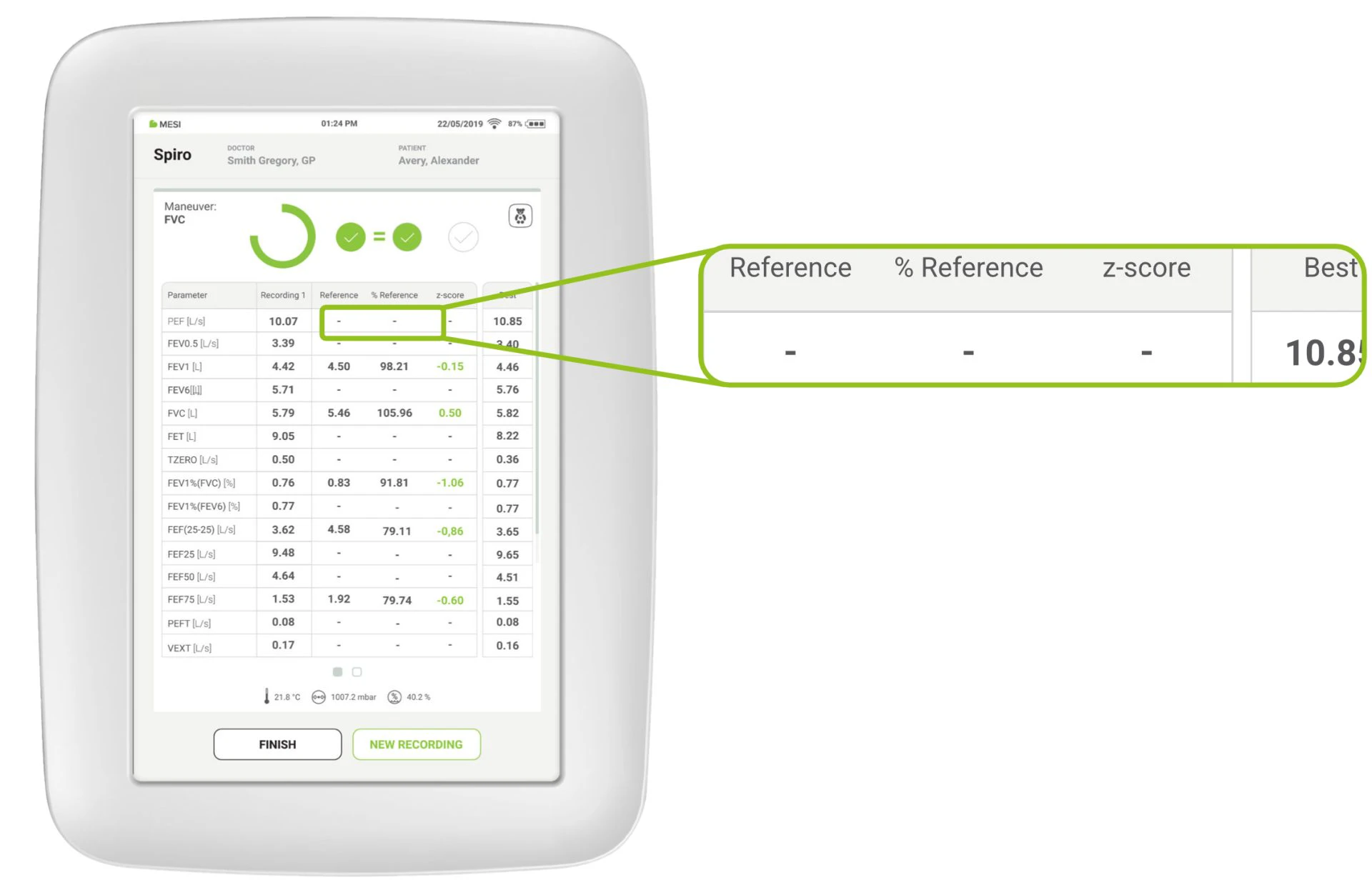 How to conduct a spirometry measurement