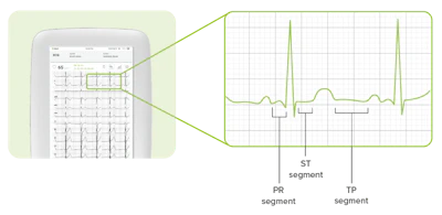 How to interpret an ECG: guide for healthcare professionals