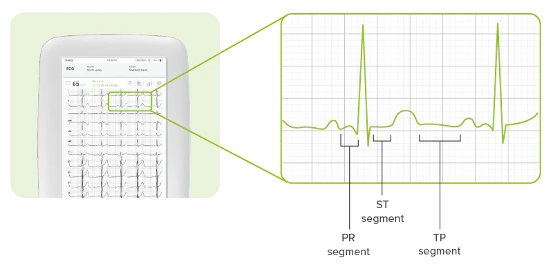 How to interpret an ECG: guide for healthcare professionals