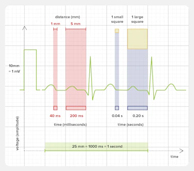 How to interpret an ECG: guide for healthcare professionals