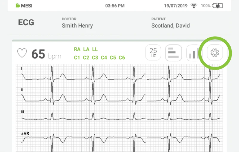 Get to know your MESI mTABLET ECG filter settings