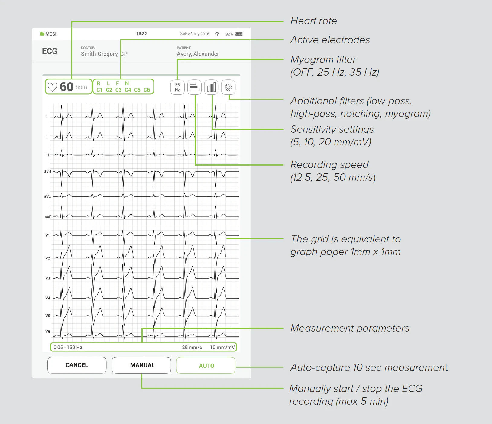 Get to know your MESI mTABLET ECG filter settings
