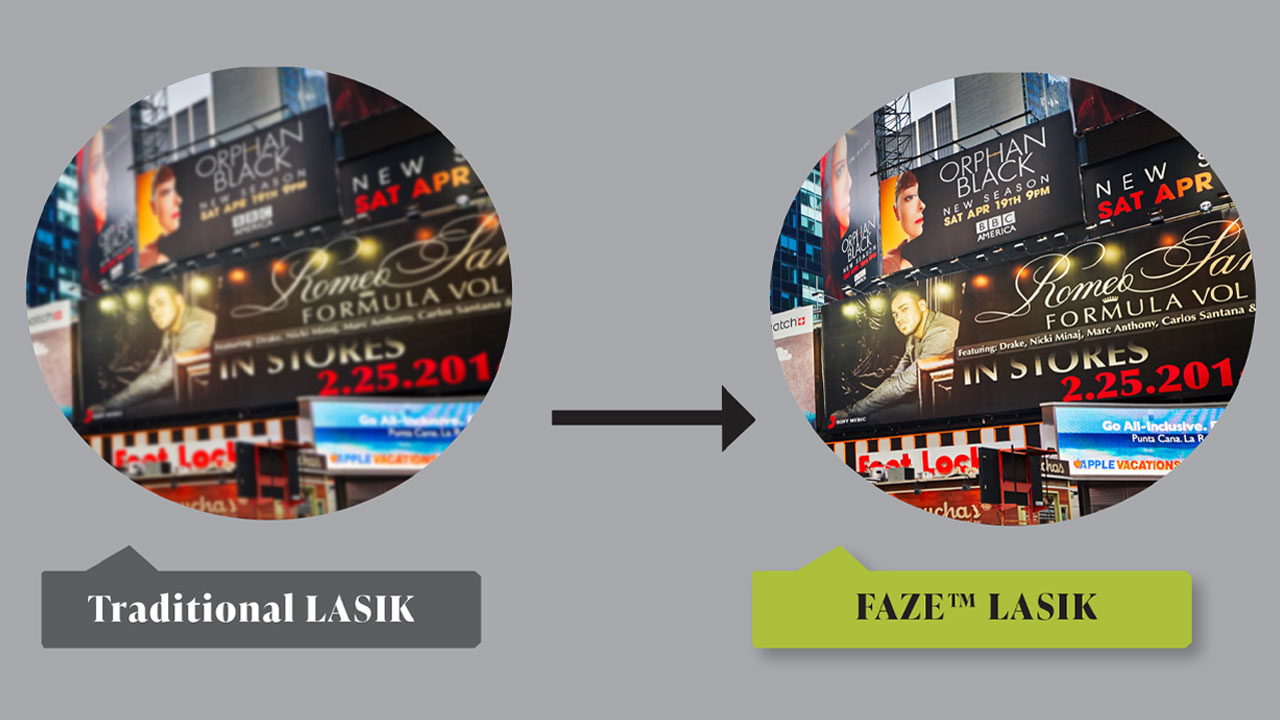 LASIK for Astigmatism: introducing FAZE™