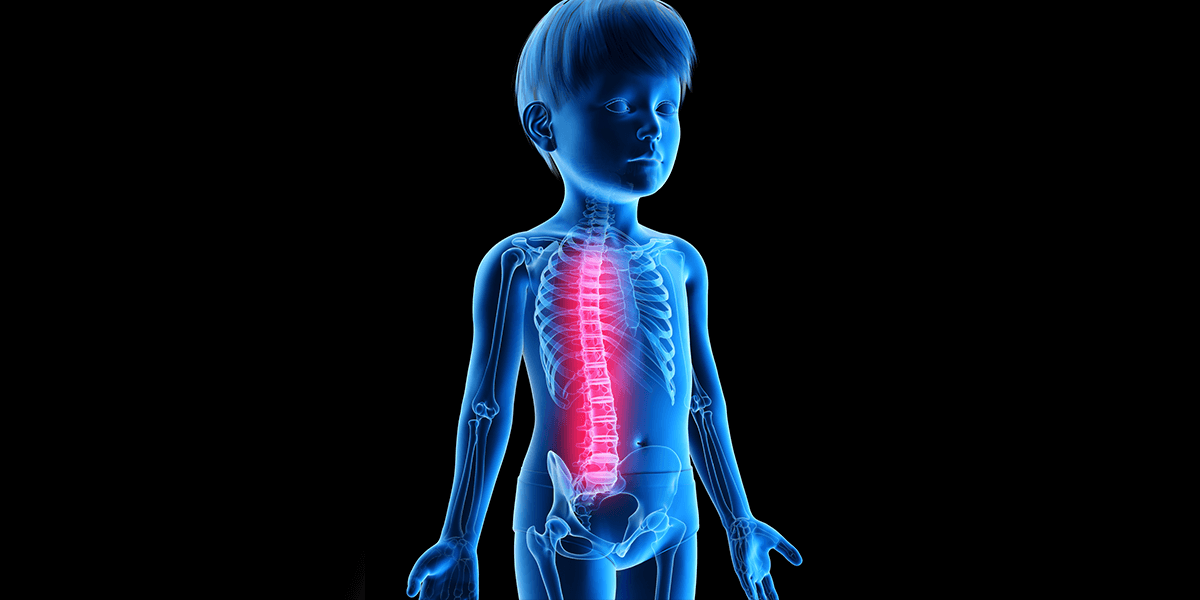 Common Injuries and Reasons for Back Pain in Young Athletes
