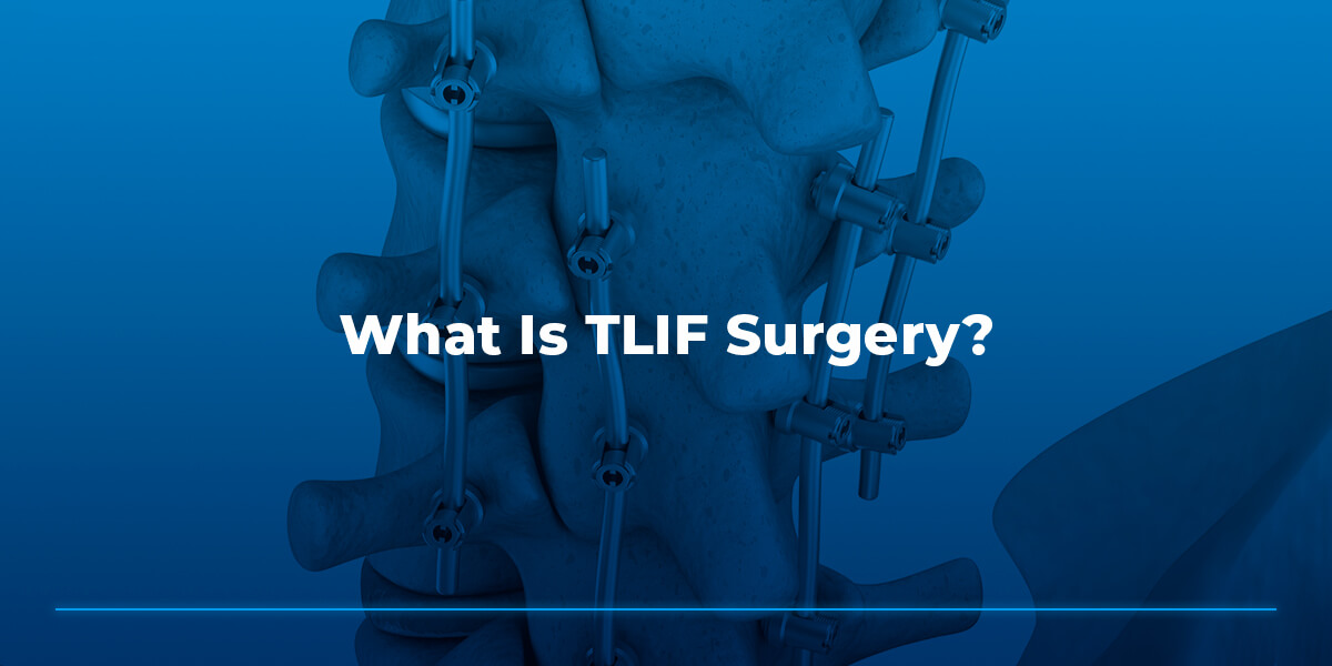 What is TLIF Surgery? | New York Spine Institute