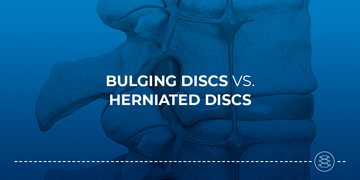 Diferencia entre un disco abultado y una hernia discal | NYSI