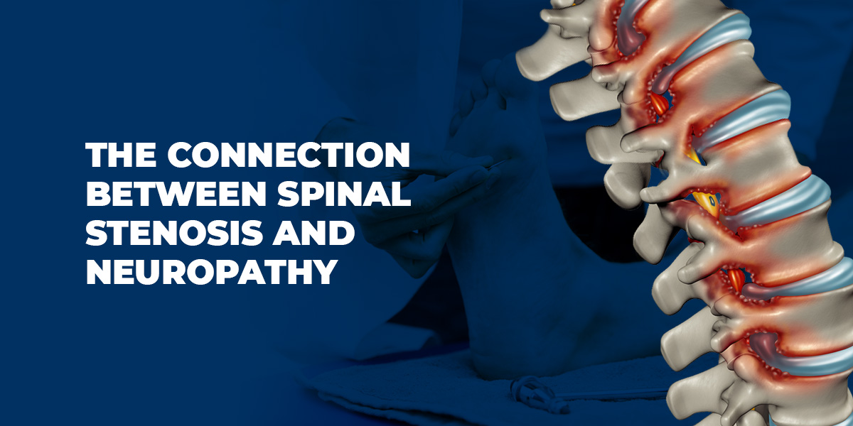 Spinal Stenosis and Neuropathy Connection | NYSI