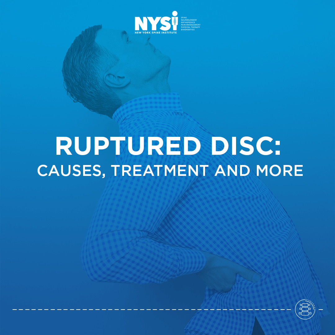 Ruptured Disc Spinal Pain Treatment | New York Spine Institute