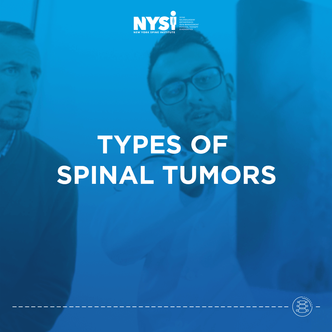 Types of Spinal Tumors | New York Spine Institute