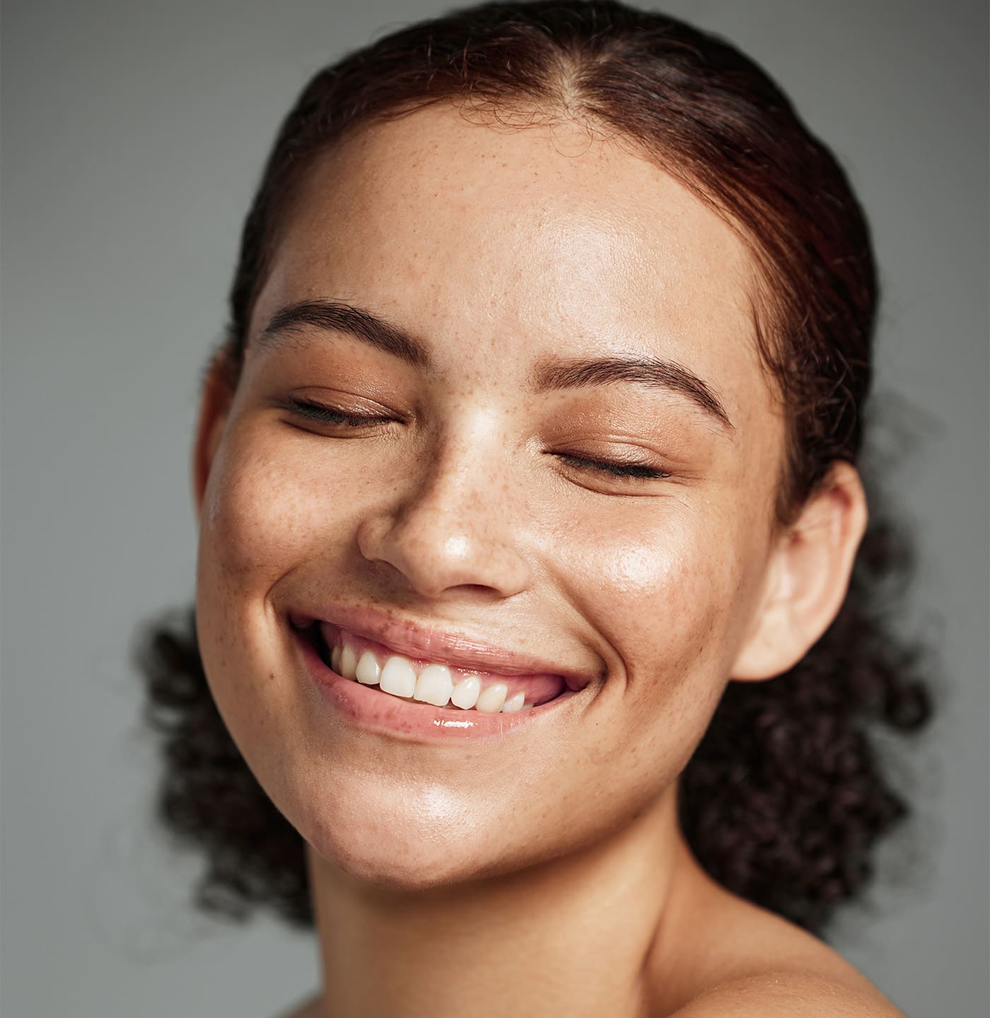 Skin Pen Microneedling in Charlotte, NC | Ageless Remedies