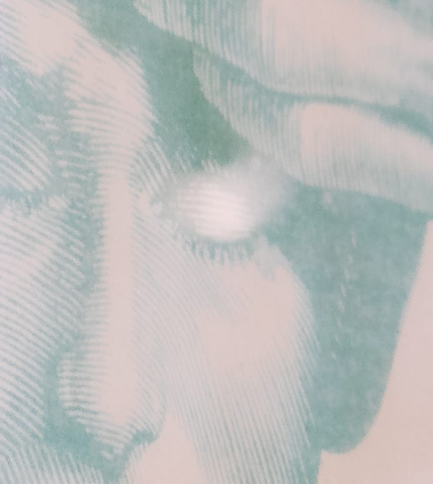 PhotoDynamic Therapy (PDT) in San Francisco | The Maas Clinic™