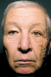 Excessive Sun Exposure while Driving can be Detrimental to your Health ...