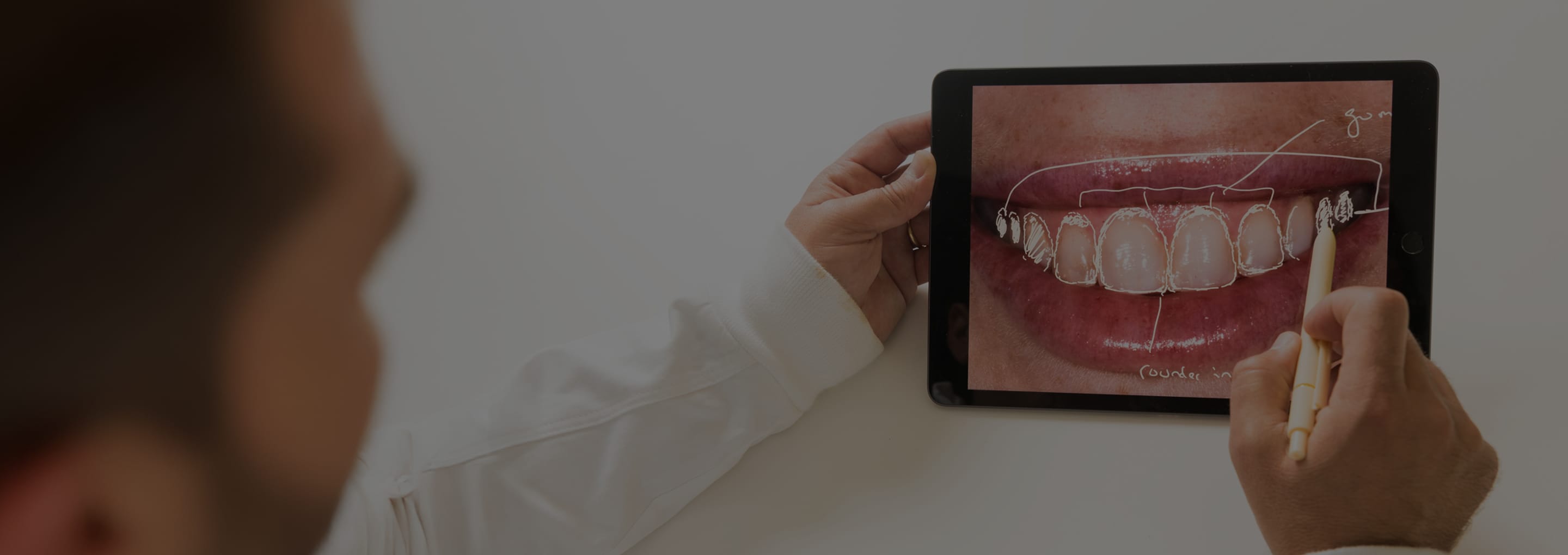 Are Diamonds on Teeth Safe? What You Should Know | Bedford Dental Group ...
