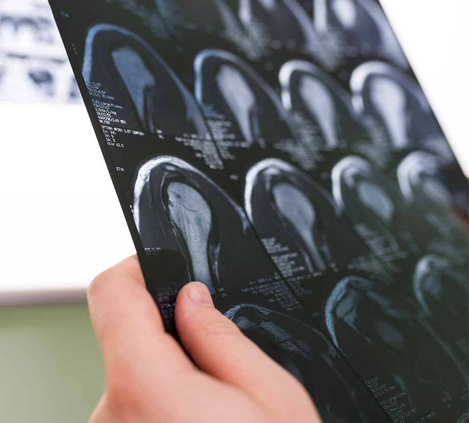 Rotator Cuff Injections TX | Musculoskeletal Injections Houston