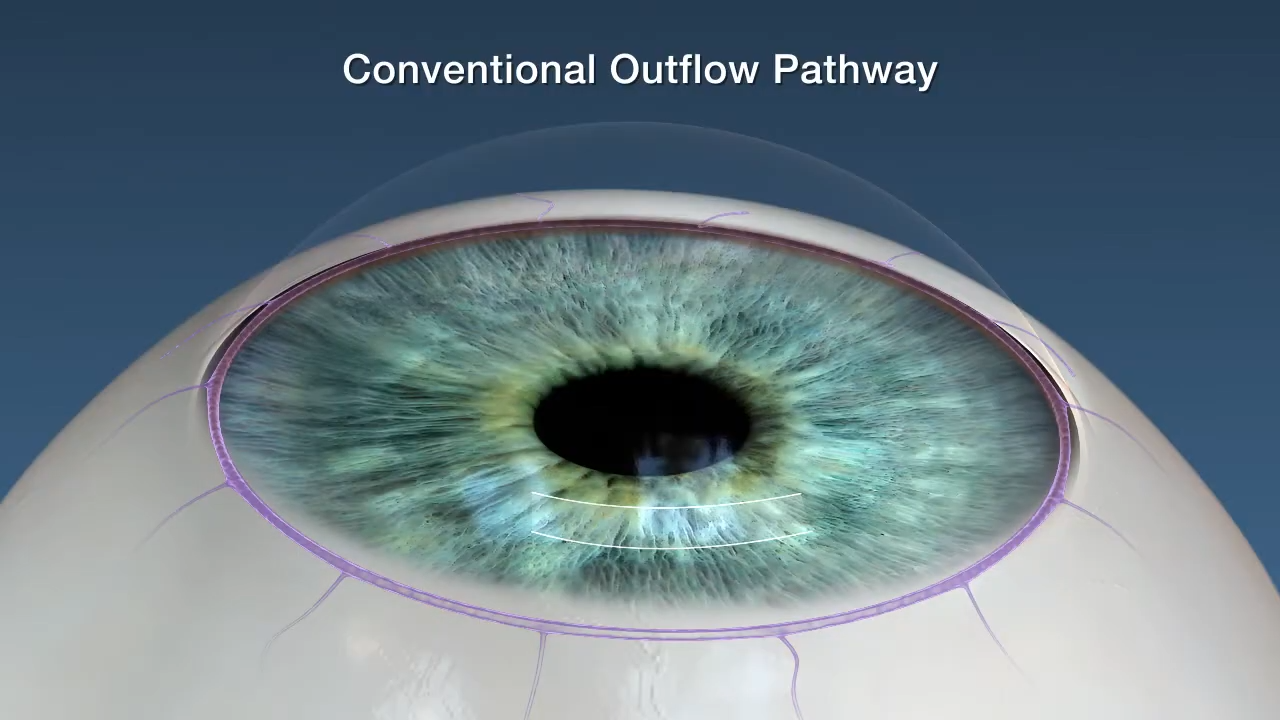 OMNI | Eye Surgeons of Indiana