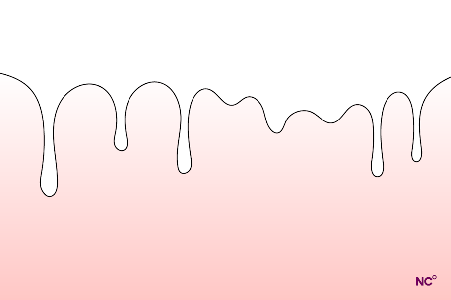 Vaginal Wetness: Types, Causes, and What is Arousal Fluid