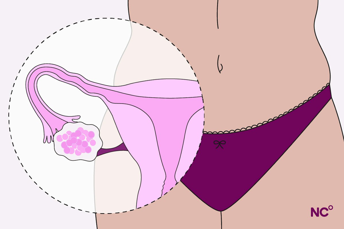 Can You Get Pregnant Without Ovulating