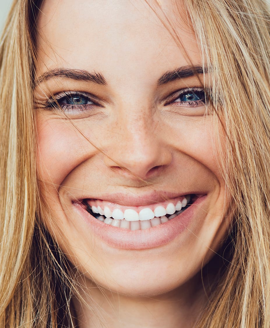 Gummy Smile | Charleston Center For Cosmetic Dentistry