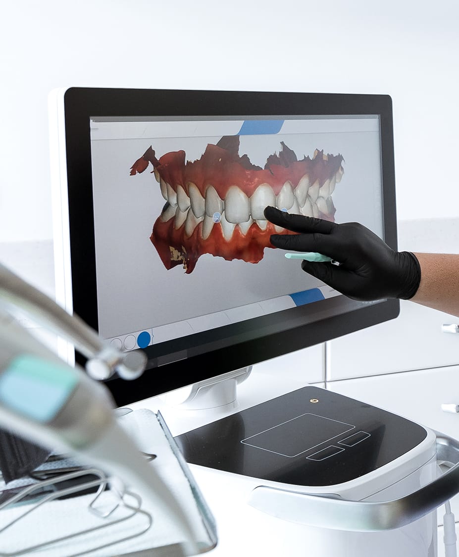 Primescan Scanner | Dr. John F. Rink