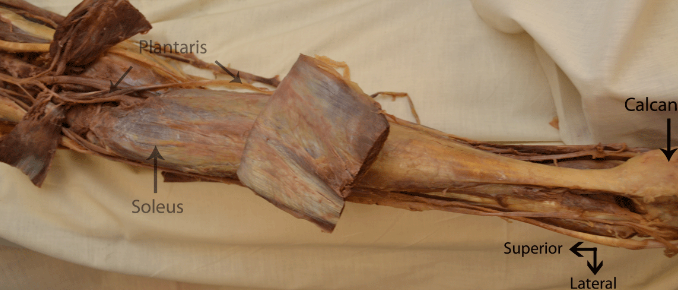 Rotatores Cadaver