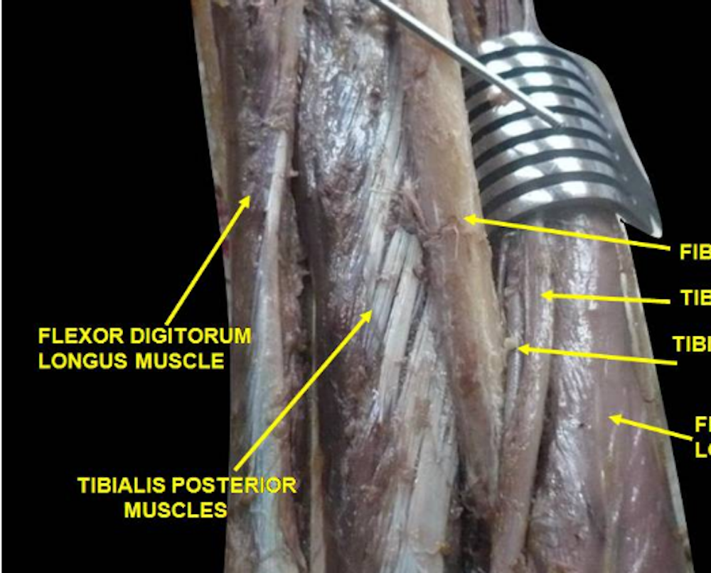 Course - Tibialis Posterior