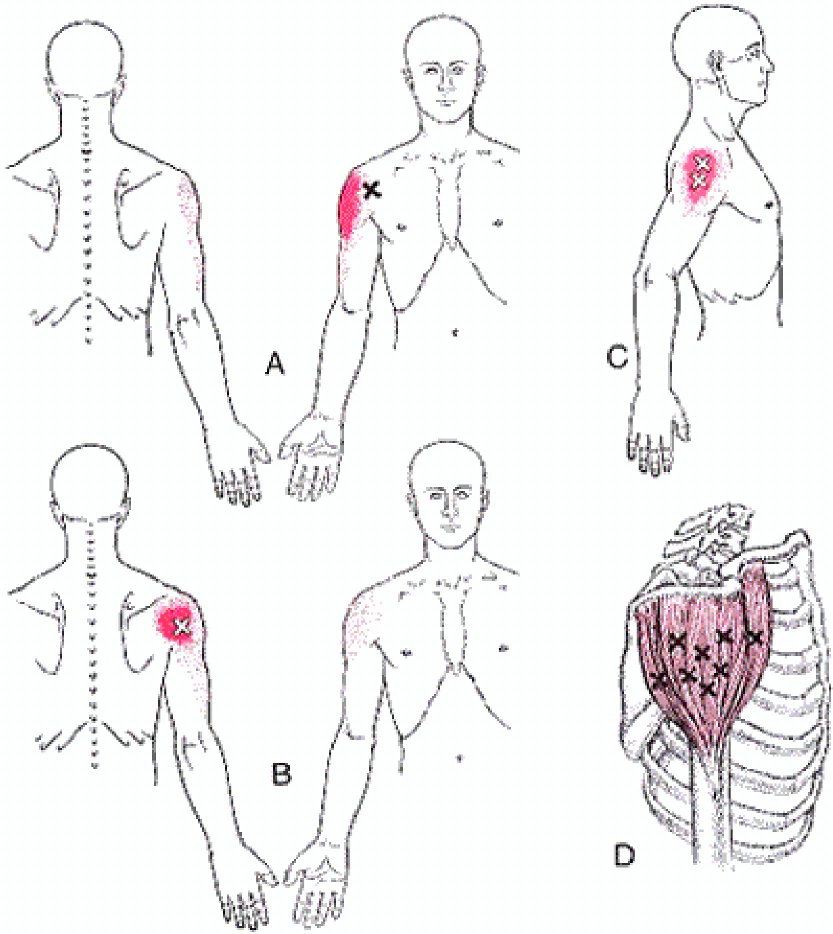 Middle Deltoid Stretch