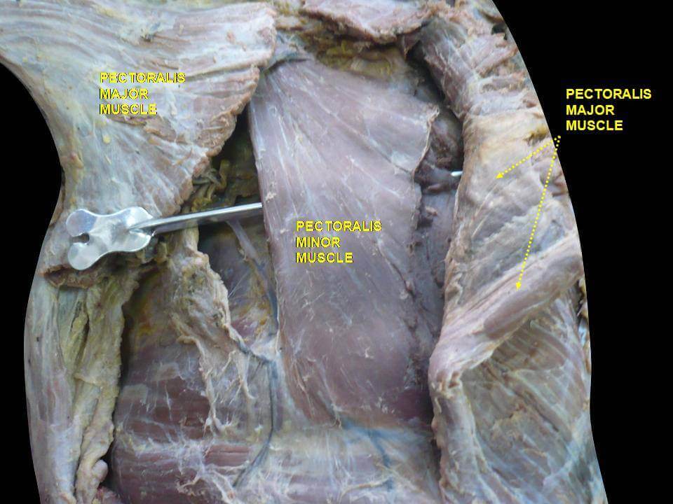 Pectoralis Major Cadaver