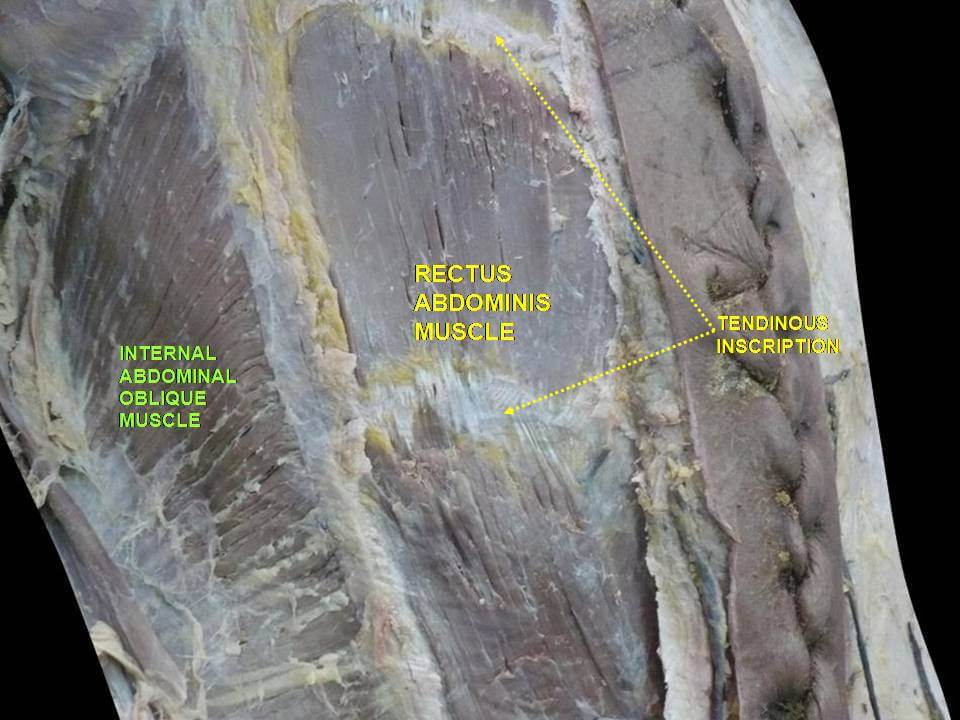 External Oblique Muscle Cadaver