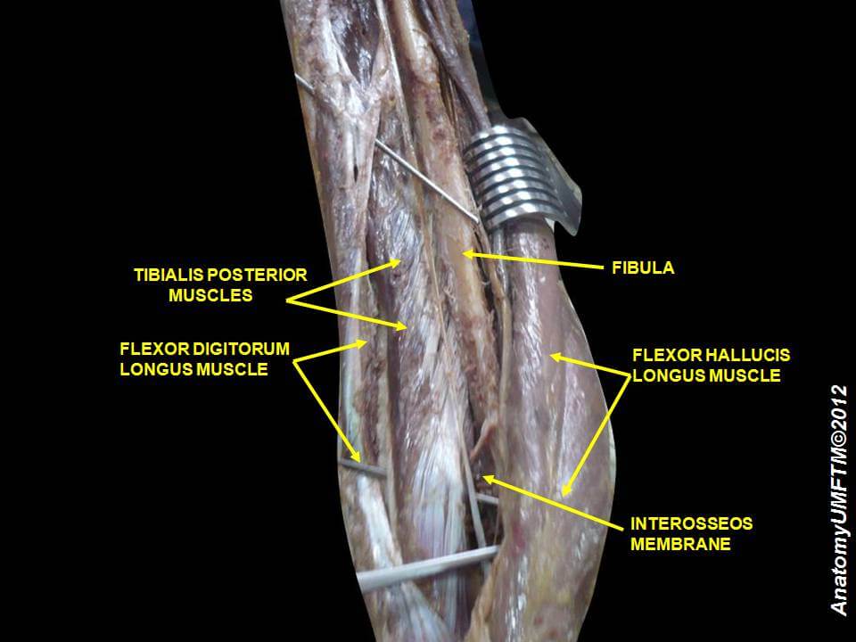 Flexor Hallucis Longus Insertion