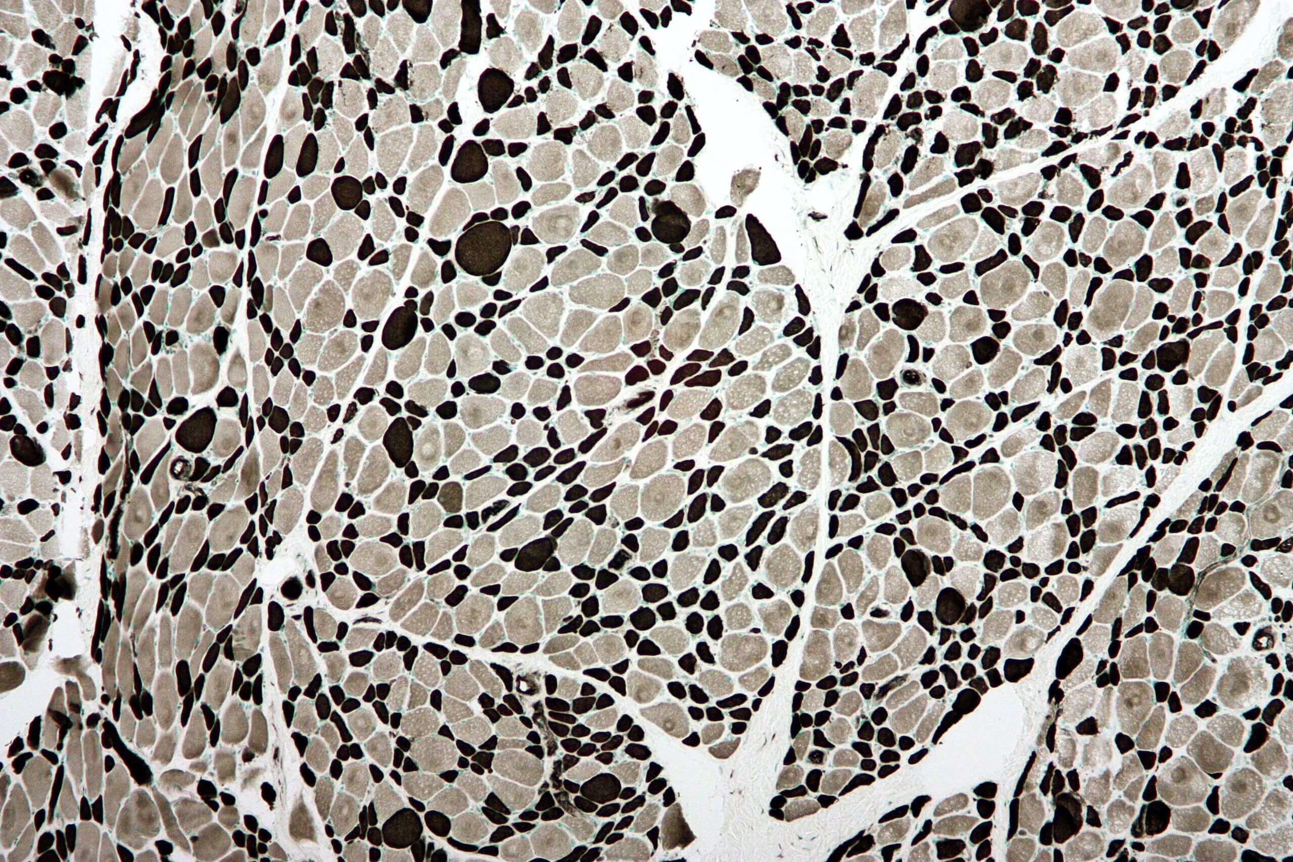 Muscle Fiber Texture