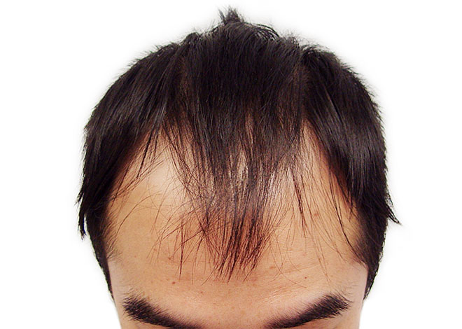 Before & After Photos | Dr. Shim Ching